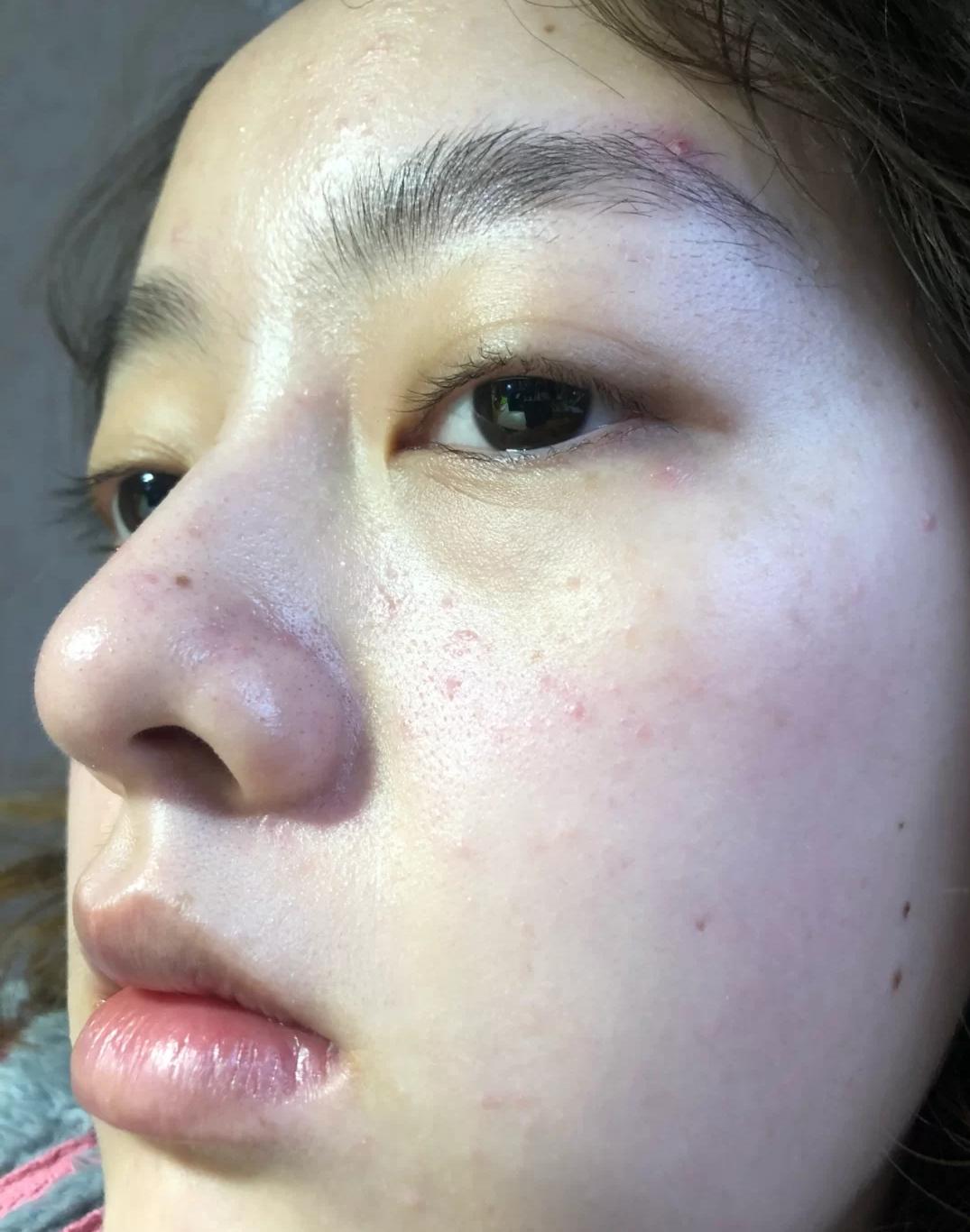 White skin is not good?Several shortcomings on the face are obvious, do ...