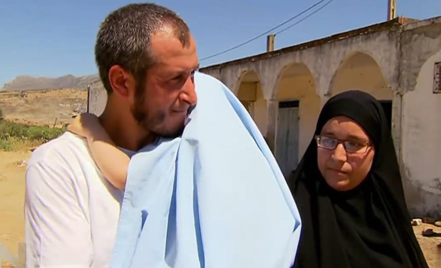The boy was born without a face. After 19 hours of surgery, his parents ...