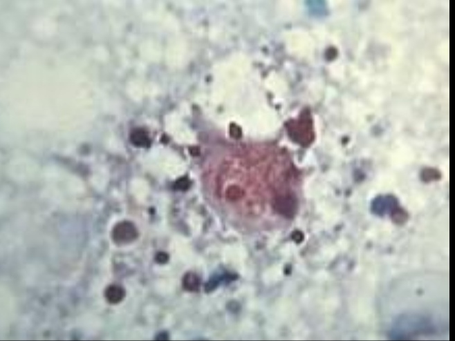 Secrets of Fort Detrick Lab - iNEWS