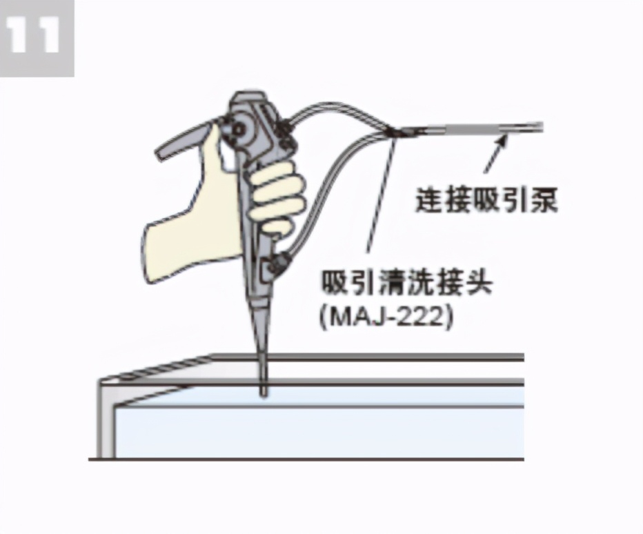 Bronchoscope cleaning guide (OLYMPUS) - iNEWS