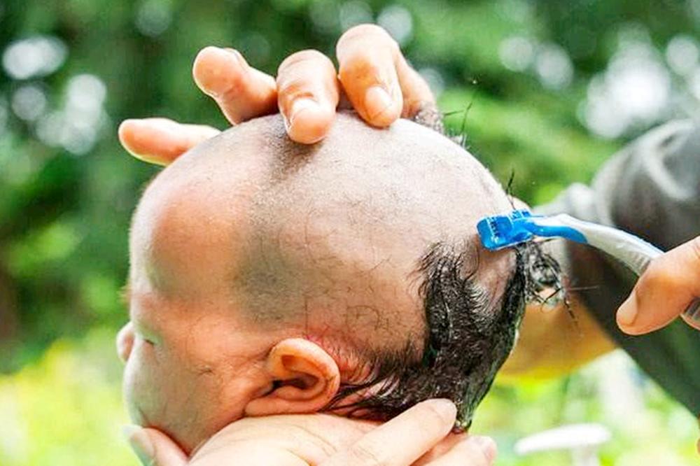 Why should baby's lanugo be preserved?Mother should know the related ...