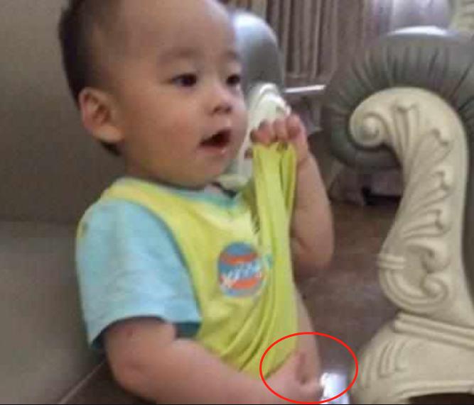 What is the "mud" in the baby's belly button?It is magnified by a ...
