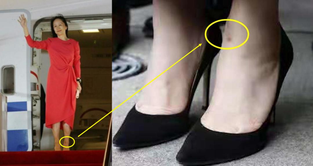 Is the "electronic fetters" that trapped her for 1,000 days, is it a ...