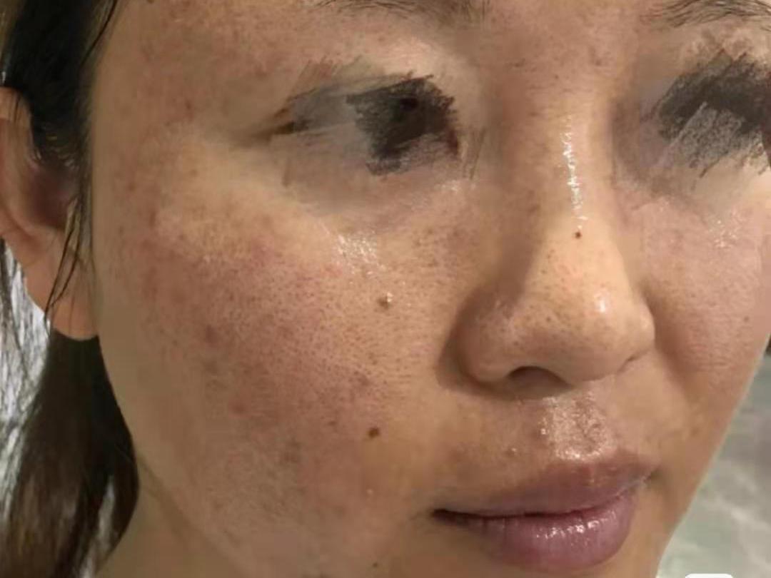 Dull skin and poor complexion?4 habits or "catalysts", regular eating 3 ...