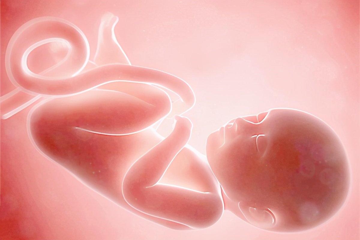 What is the "mud" in the belly button?Can you pull it?Look at the ...
