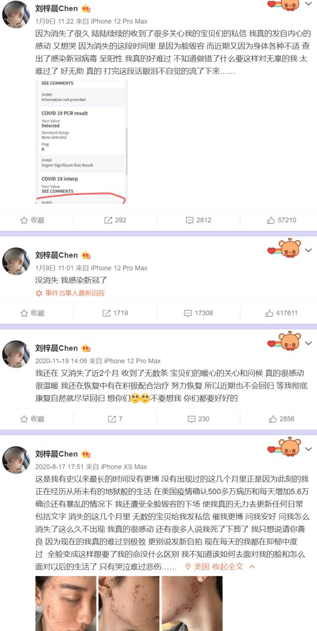 Internet celebrity Liu Zichen rarely shares unretouched photos, the real face is exposed, not ...