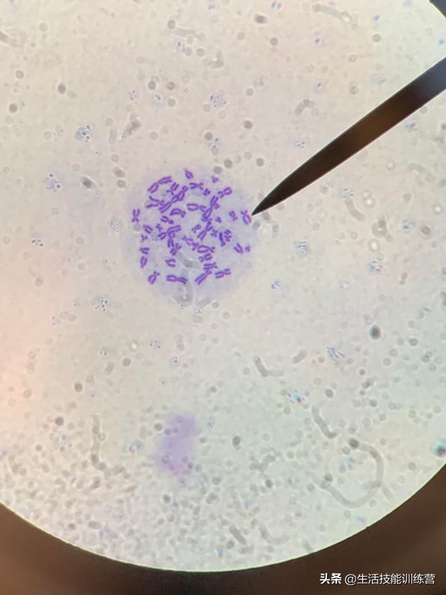 Wonderful microscopic world, 30 pictures show how everyday objects look ...