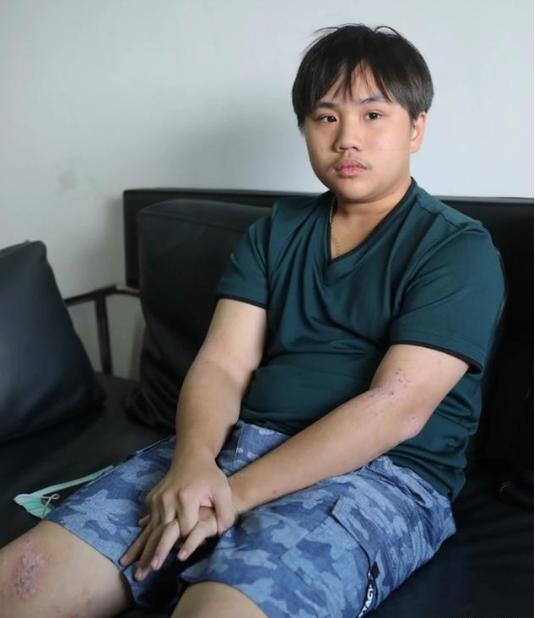 Tongxing Xiao Xiaobin, after being squeezed by the parents, after the mother, the skin is ulter ...