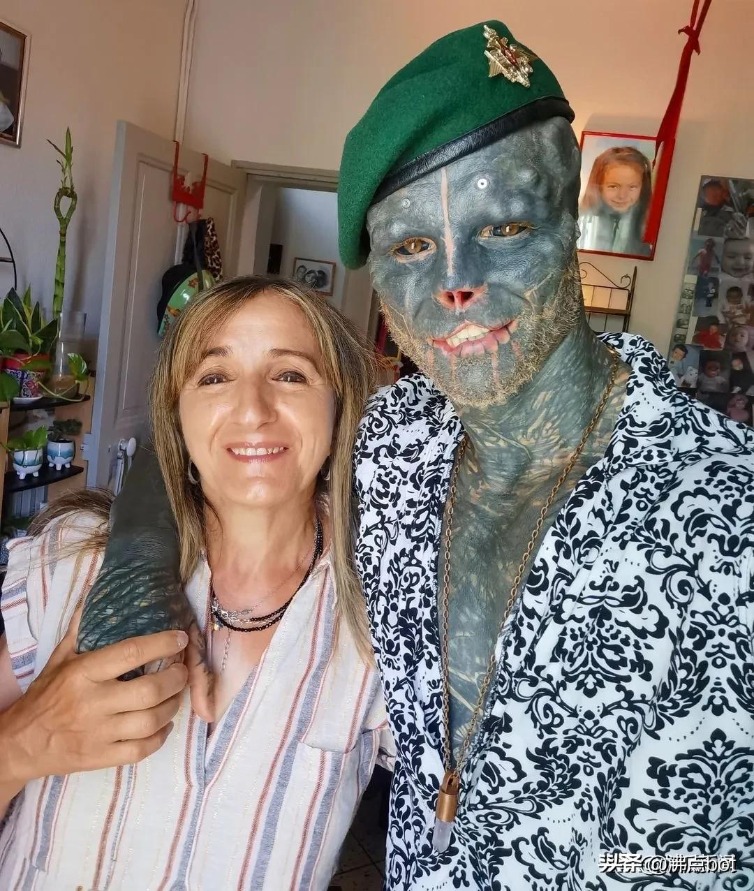 The man dreams of becoming an alien wants to cut off 4 fingers and has ...