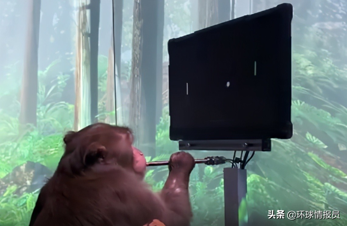 The future is here!Musk's brain-computer interface is implanted in ...