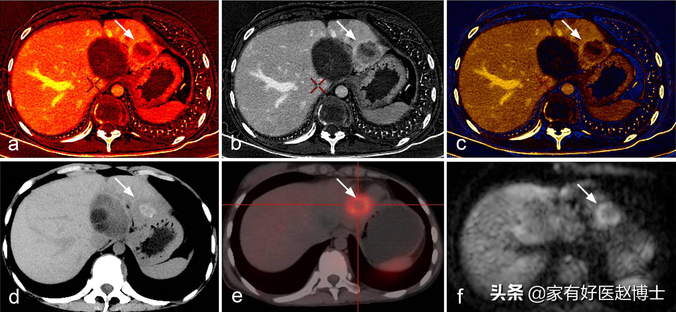 How much is the dazzling whole body cancer screening test worth doing ...