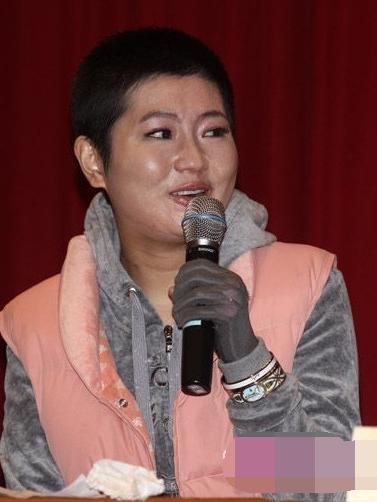 39-year-old SELINA full body package is strictly seeing fire scars, and ...