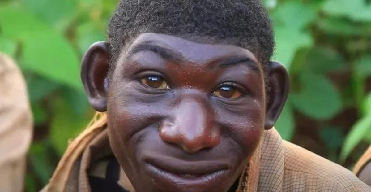 The Rwandan guy looks like an ape and was bullied by the villagers: You ...