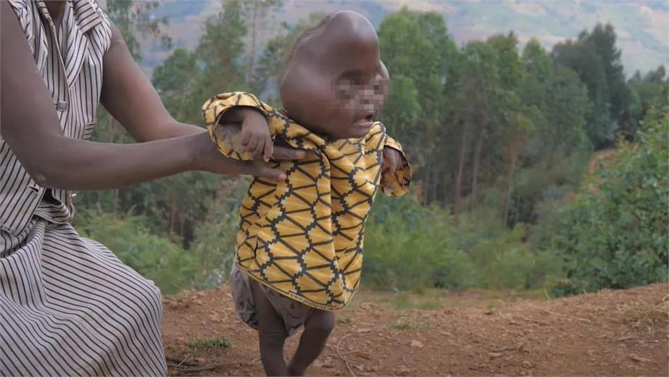 Son of an alien?The Rwandan baby has a triangular head and a weird ...