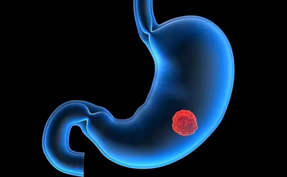 Many people don't pay much attention to chronic gastroenteritis. - iNEWS
