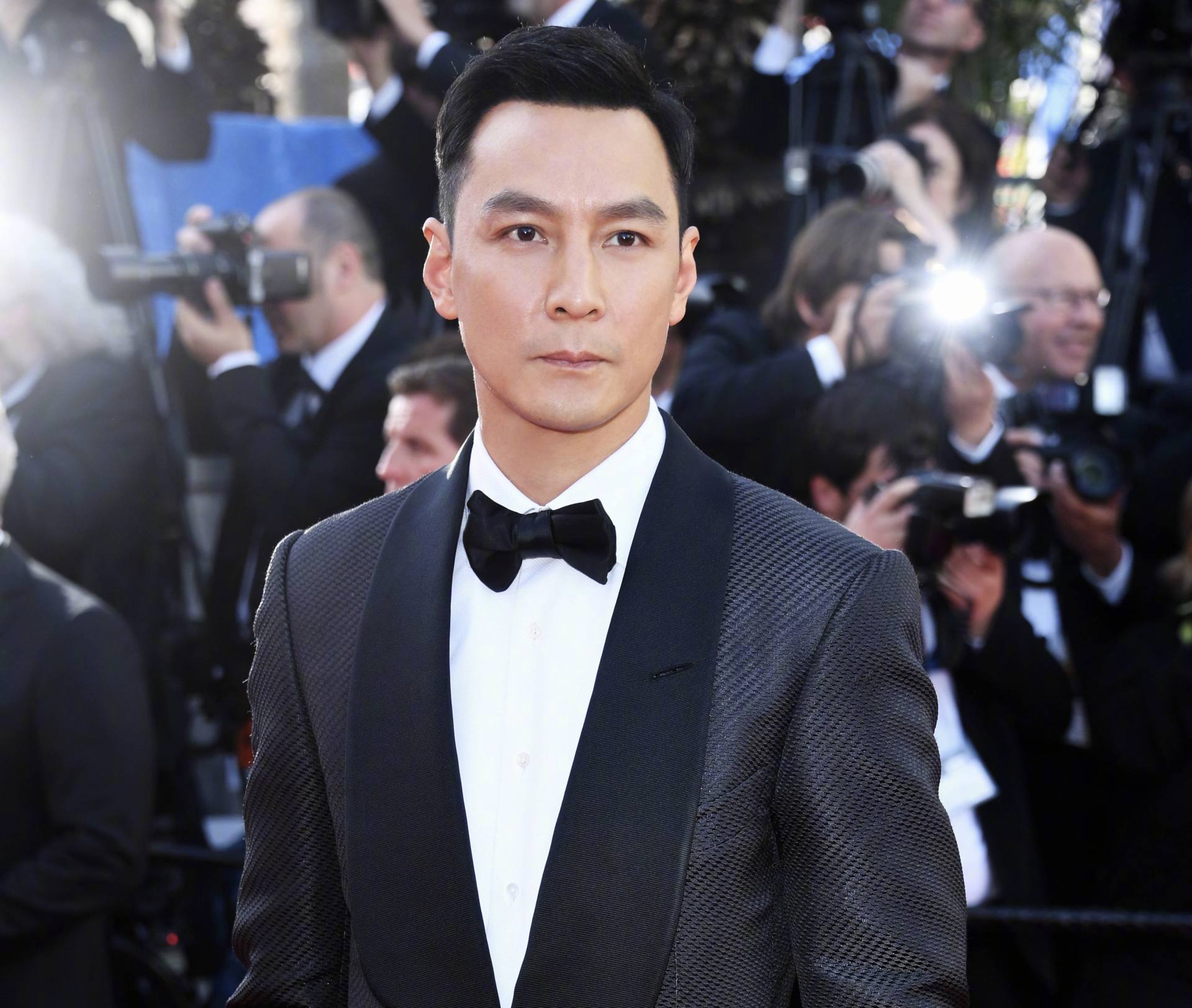 Male god Wu Yanzu suffered from allergic dermatitis due to poison ivy ...