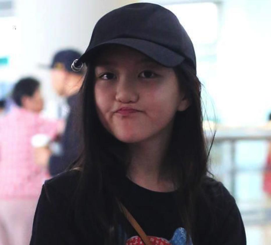 Simba's apprentice Han Meijuan suns photos of cleft lip and palate ...