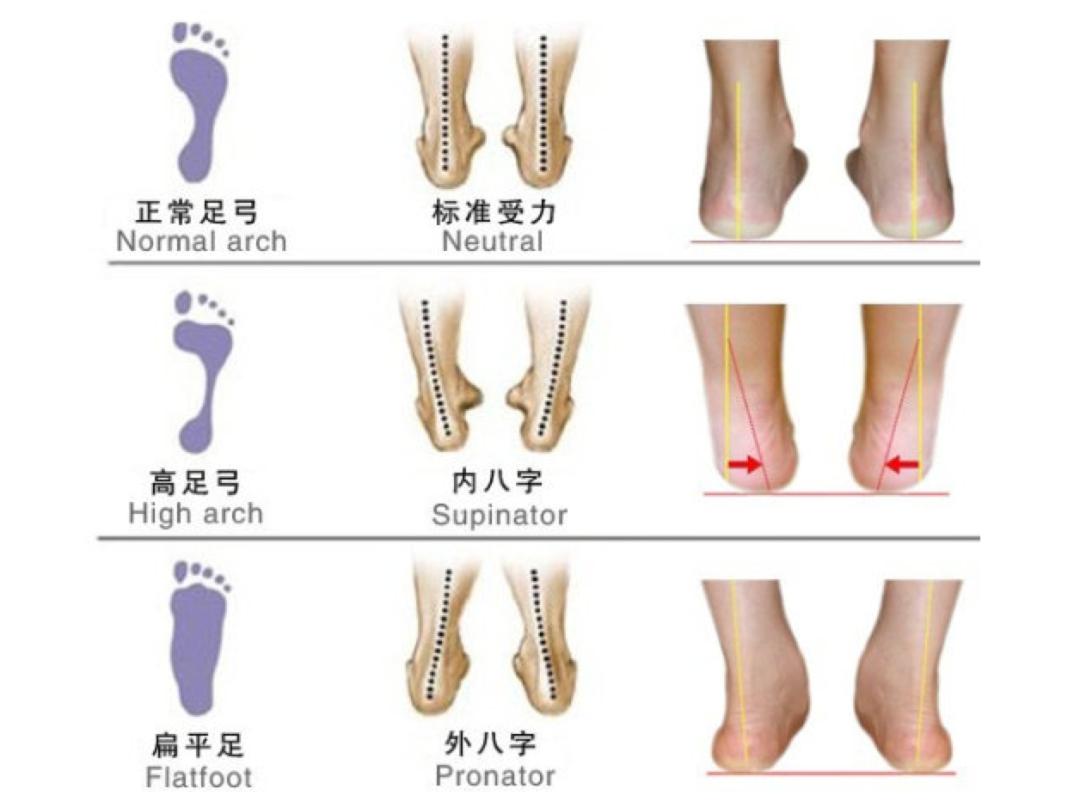In middle age, the arch of the foot gradually "collapses"!A footprint ...