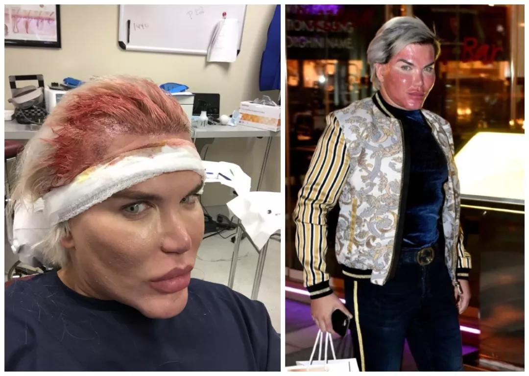 "Real Kenny" was obsessed with plastic surgery for many years, and ...