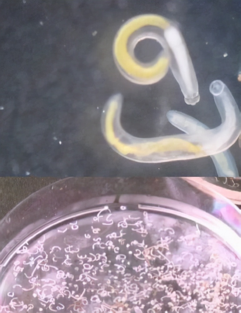 Are there many parasites in rice field eel?Will eating rice field eel ...