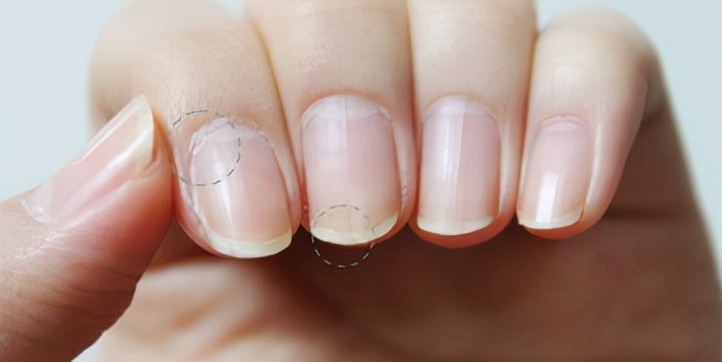 What do vertical lines, horizontal lines, bruises, and crescent nails ...