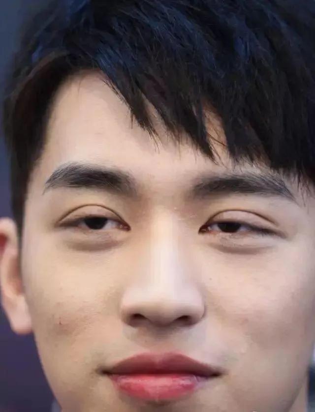 Xu Weizhou's double eyelid surgery transforms apathetic eyes - iNEWS