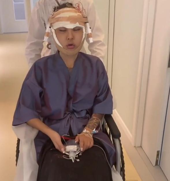 The net celebrity's excessive plastic surgery caused the forehead to ...