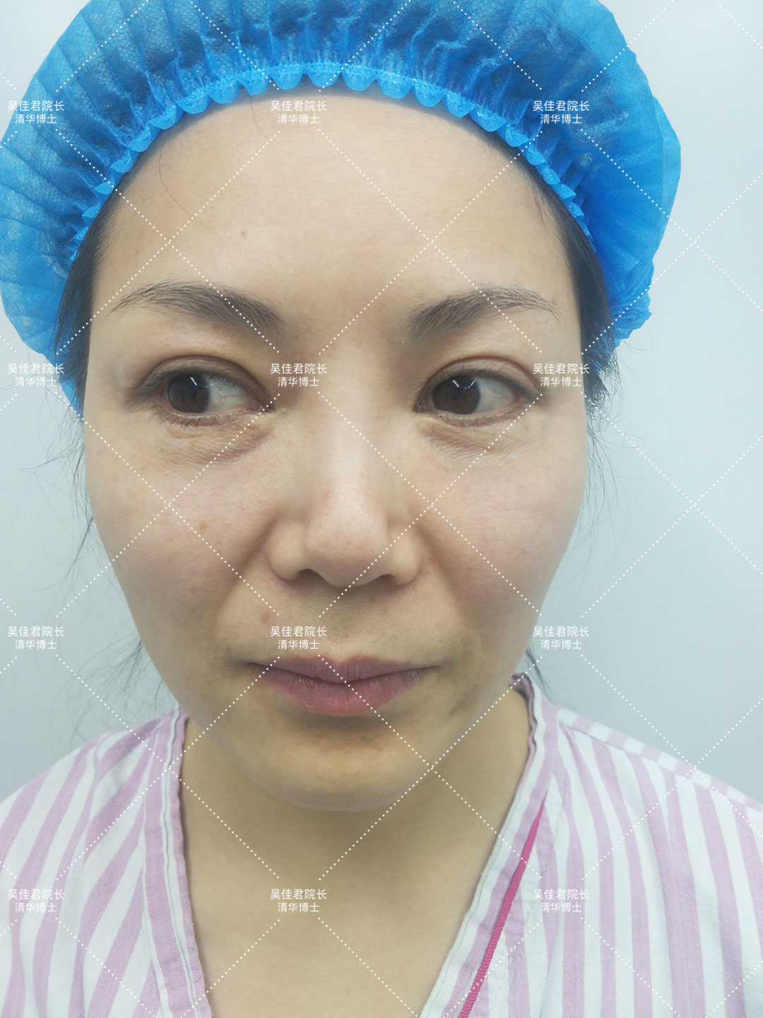 In her 30s, her face collapsed like a 50-year-old aunt. She ...