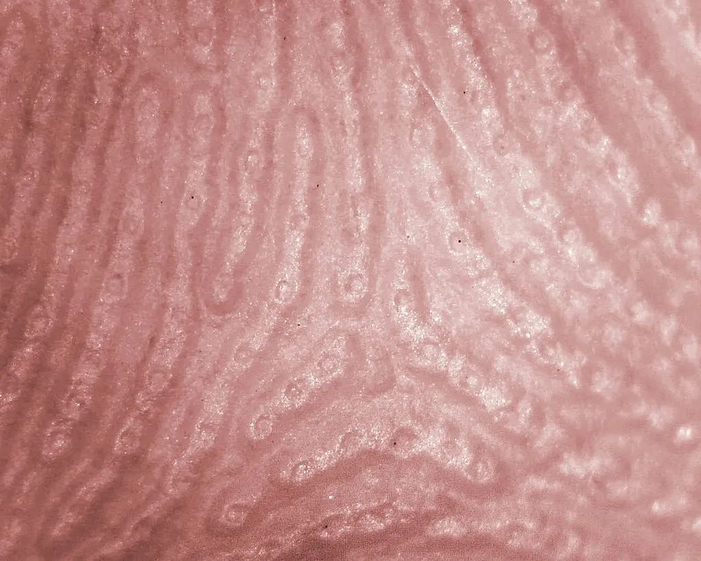 Will those who are born without fingerprints become true extrajudicial ...