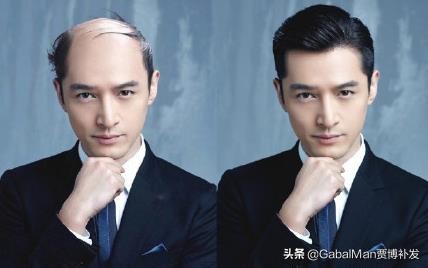 How important is the hairstyle?When I saw Hu Ge and Wu Yifan's "bald ...
