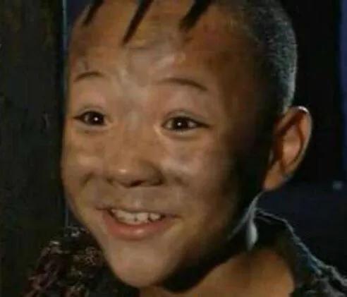 Due to the role of "San Mao", causing diseased baldness, the current ...