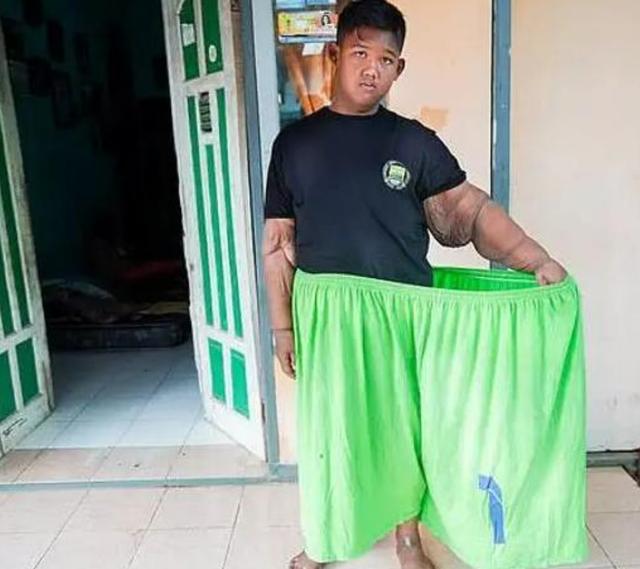 The fattest kid in the world who is 400 kilograms, loses weight crazy ...