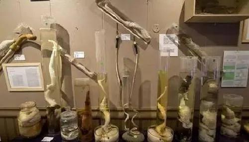 Human lost "Ding Ding bones", which is the body? Is it evolution or ...