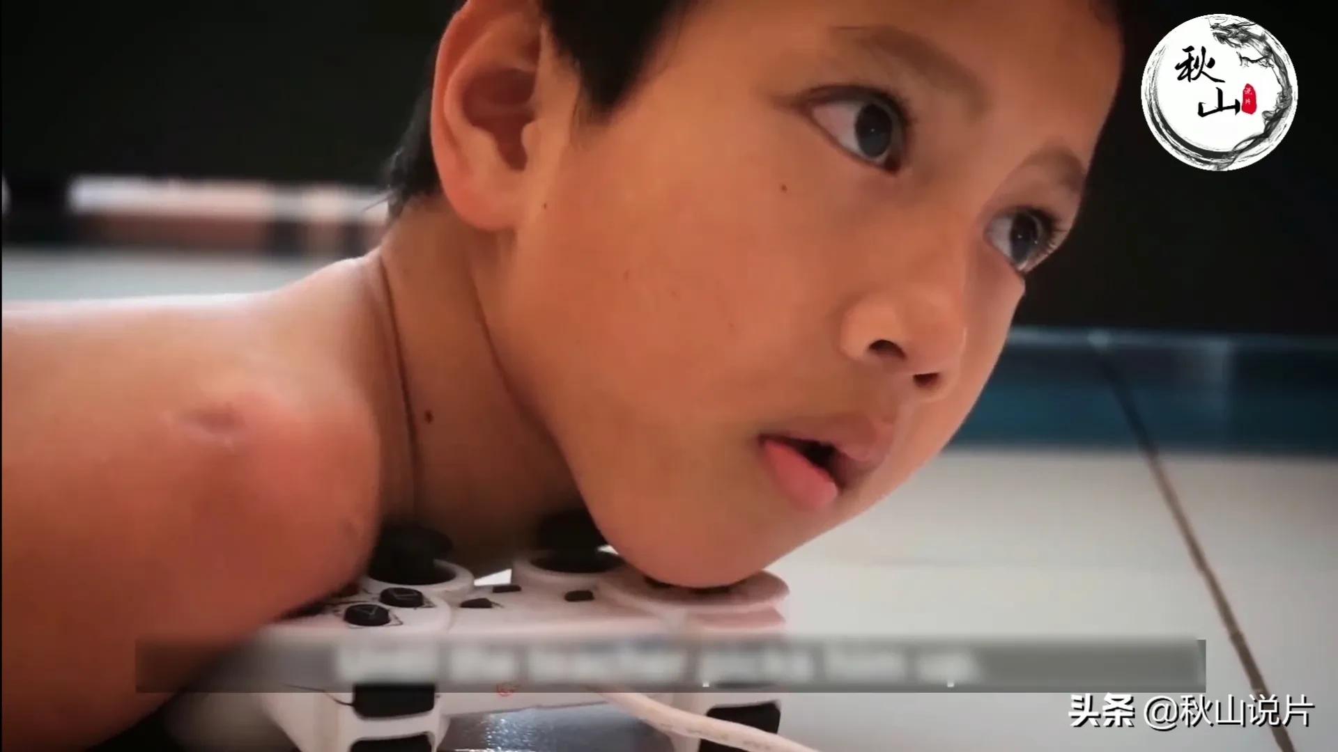 Born without limbs, he learns very well, and he can play games with his ...
