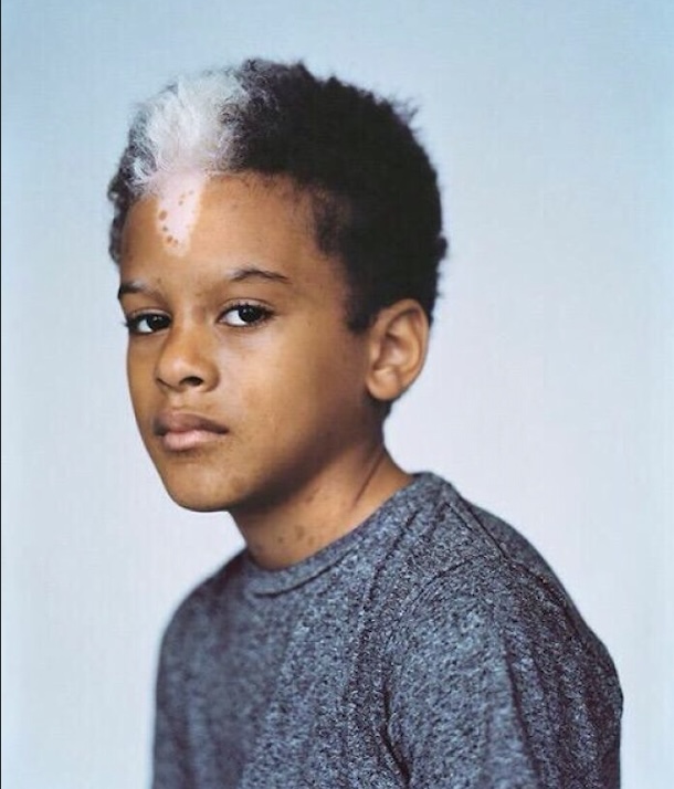 After reading the rare genetic mutations in the human body, I feel that ...