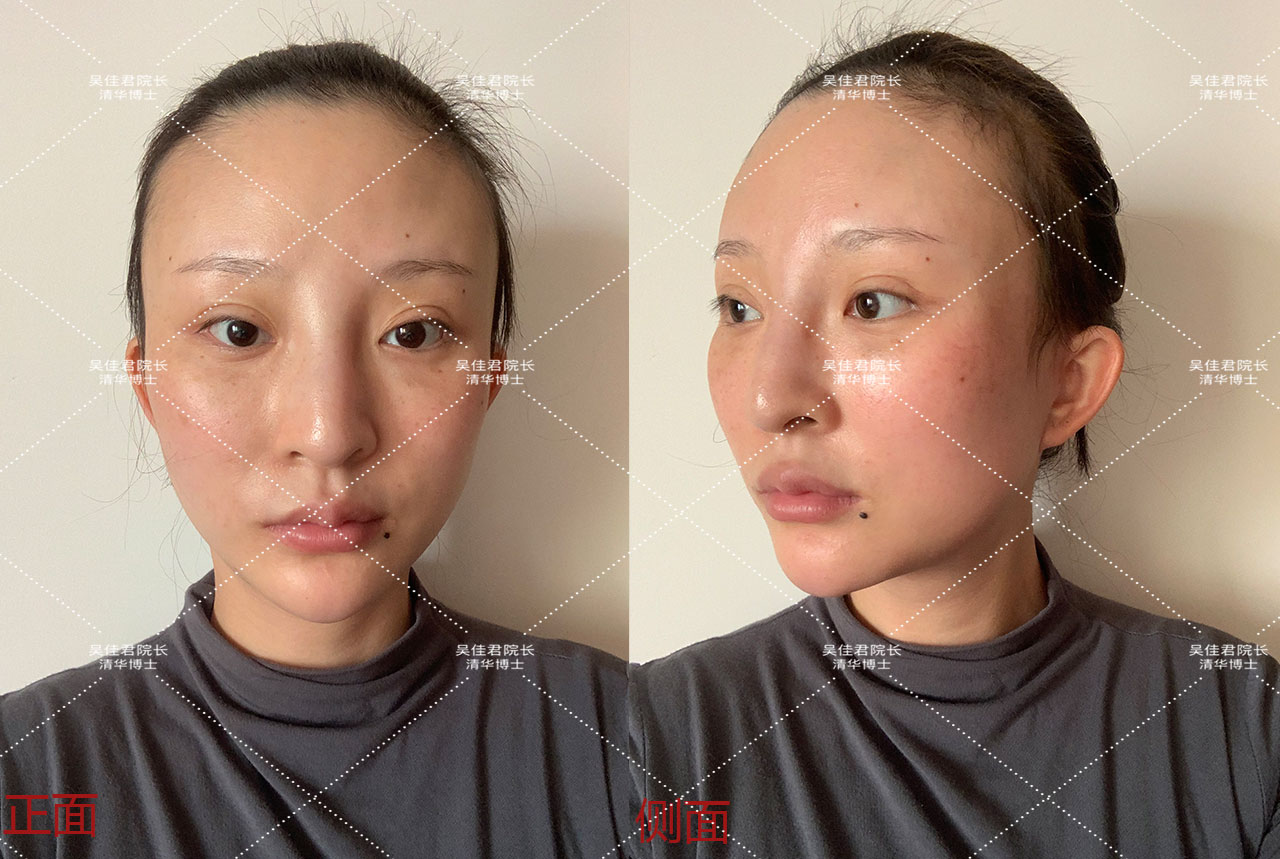 Face collapsed when he was only in his 30s?do not be afraid!Little Lapi ...