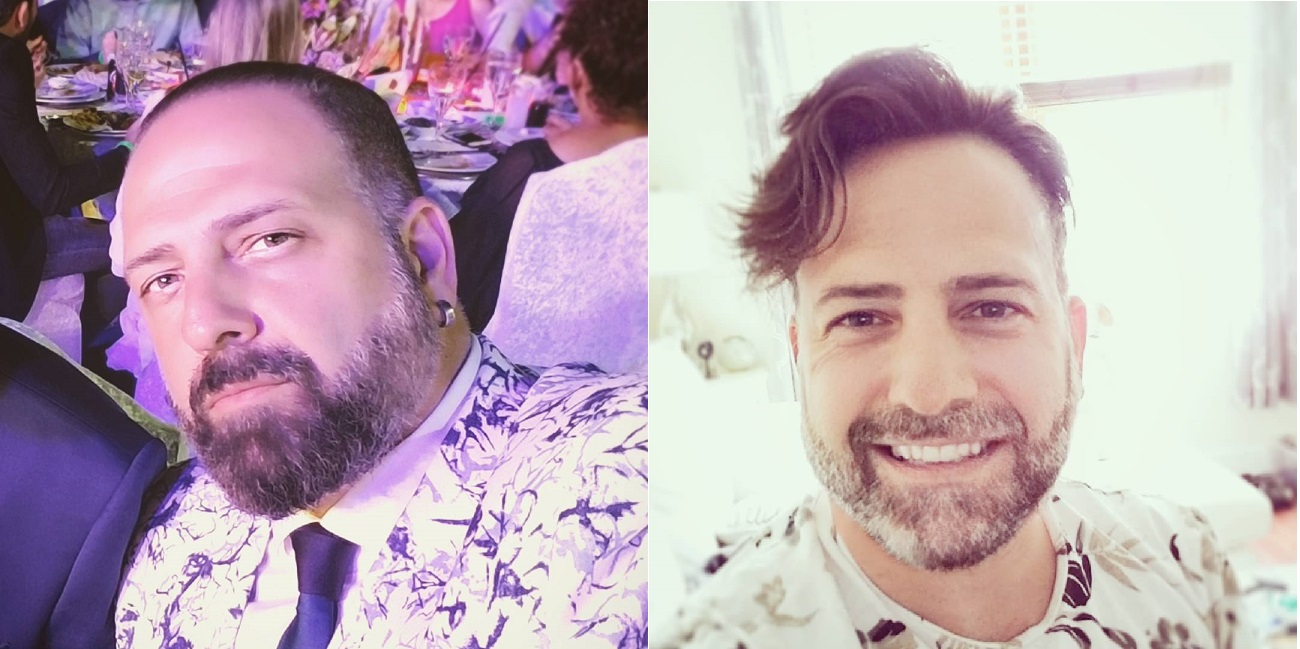 Is the round face too fat? That's because you didn't choose the right ...