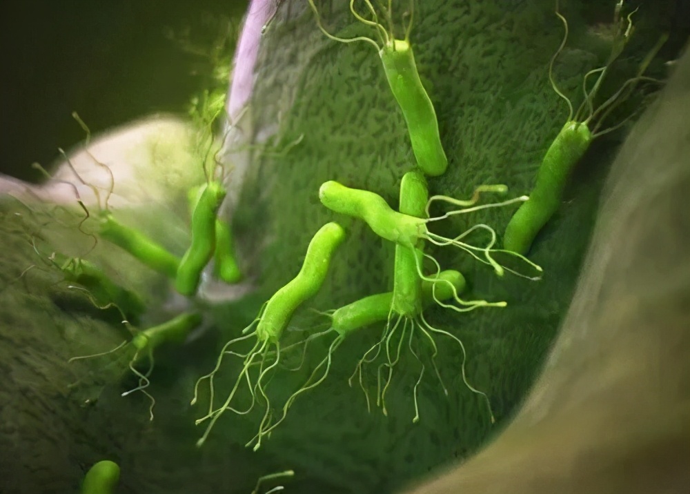 Helicobacter pylori was discovered by scientists drinking bacterial ...