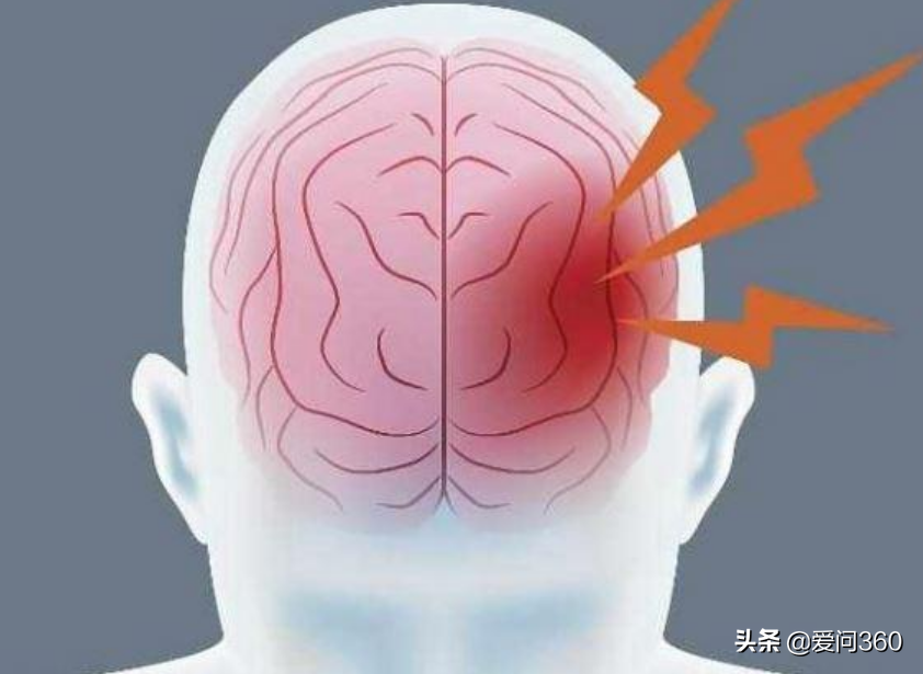 Is cerebral congestion related to lifestyle habits? It's not nonsense ...