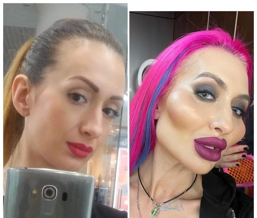 Ukrainian internet celebrities have a facelift!The beautiful photos ...
