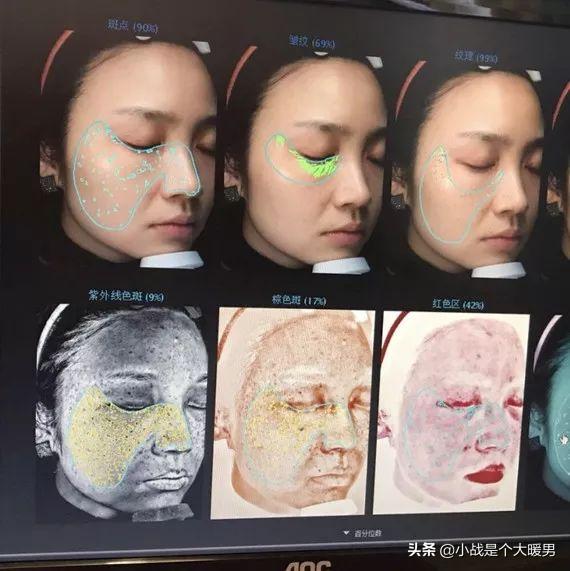 Dark yellow skin with spots?1 skin care tips to remember, let you ...