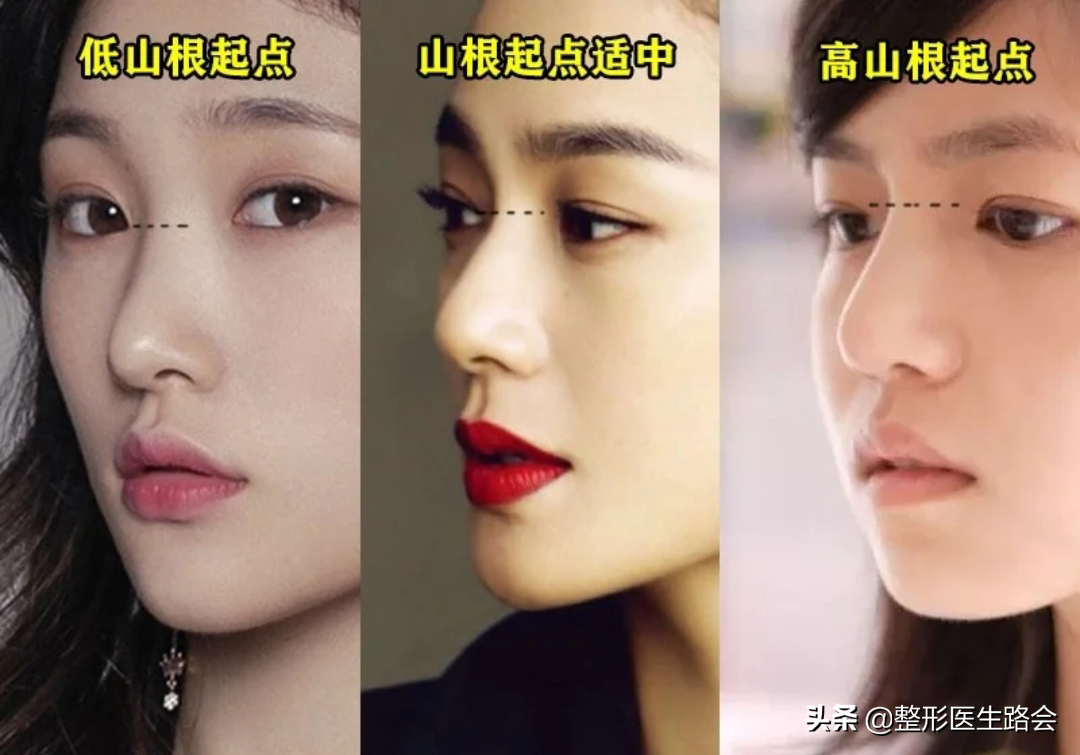 Straight nose, straight nose slightly curled, curled nose, slightly ...