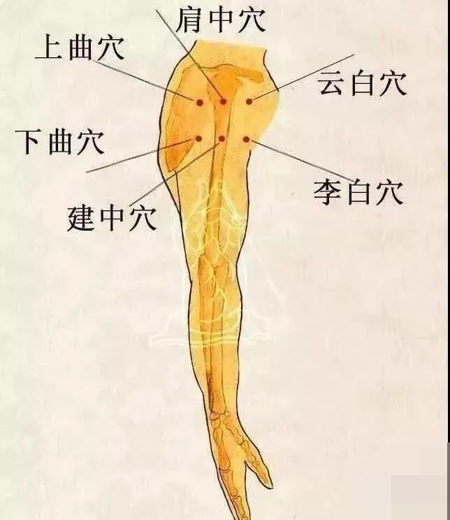 TCM acupuncture and upper extremity disease prescription 6 - iNEWS