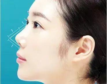 What is a short nose? How to improve the short nose to make it more ...