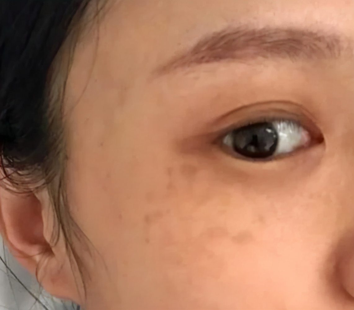 Dull skin and poor complexion?4 habits or "catalysts", regular eating 3 ...