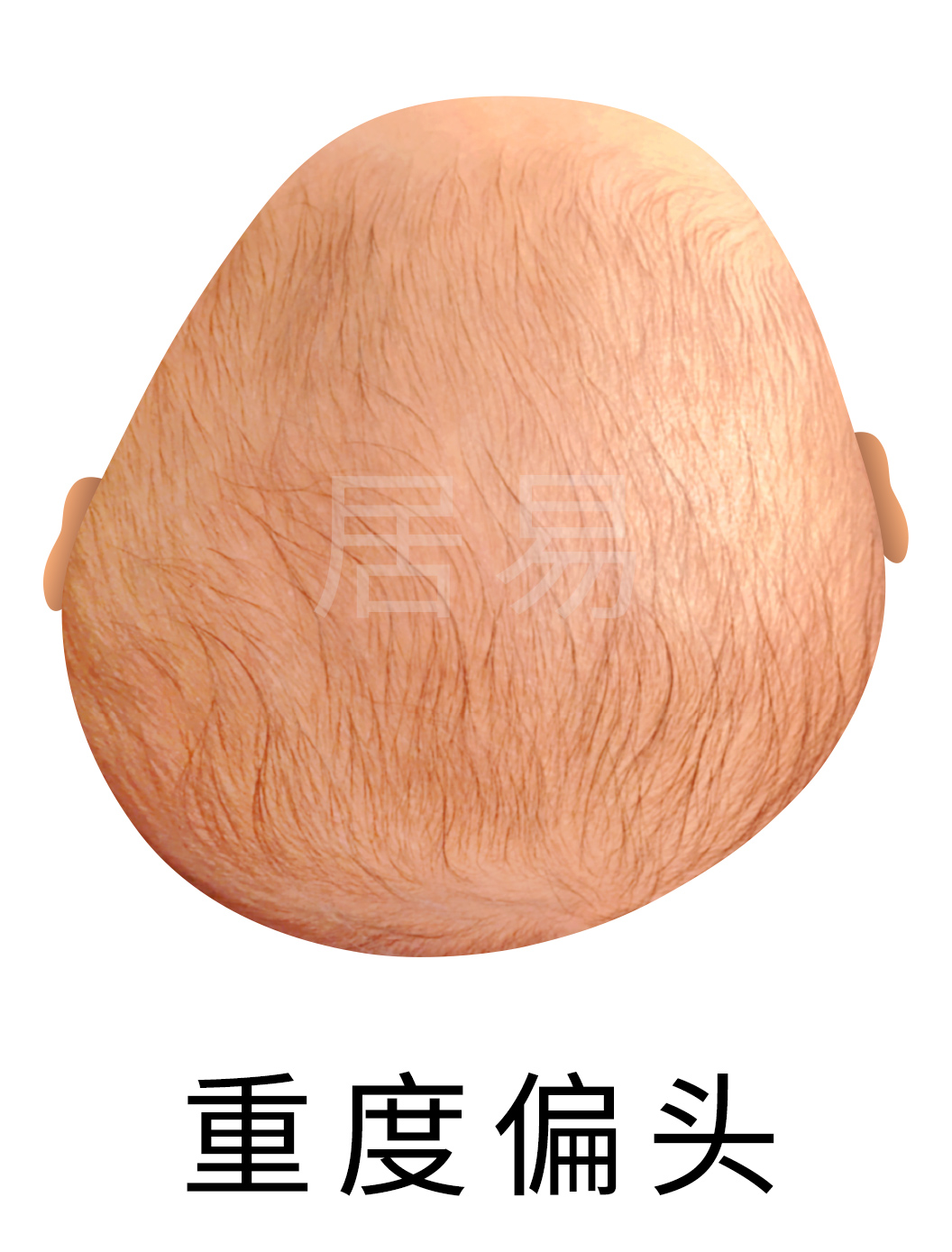 The secret of baby's head shape (8) Shortcut to correct head deviation ...