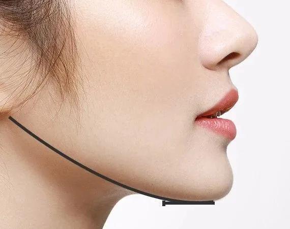 In her 30s, her face collapsed like a 50-year-old aunt. She ...