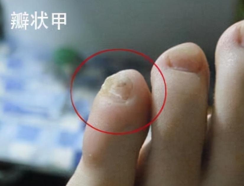 The Huns did not perish?Are you a Han or a Huns, look at your little ...