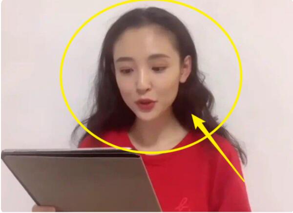 There is a kind of "plastic surgery" called Shengbab. The 28-year-old ...