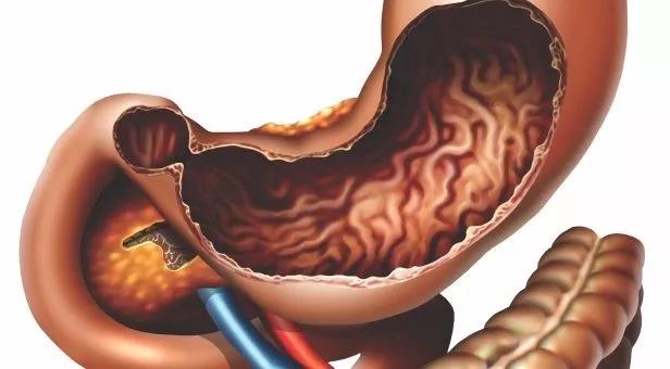 He made a hole in his stomach and completed 238 human experiments in 8 ...